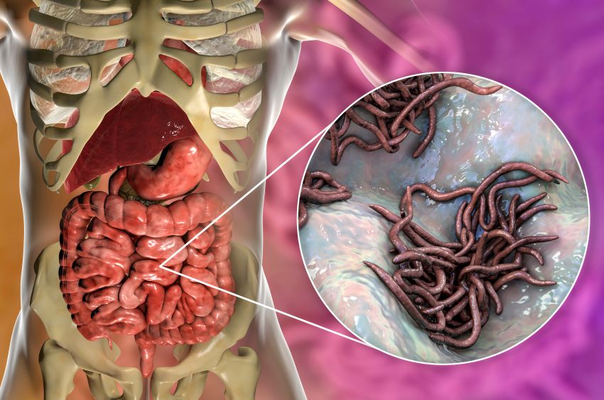 Cum tì dai seama că ai viermi intestinali. 20 de semne ale paraziților ...